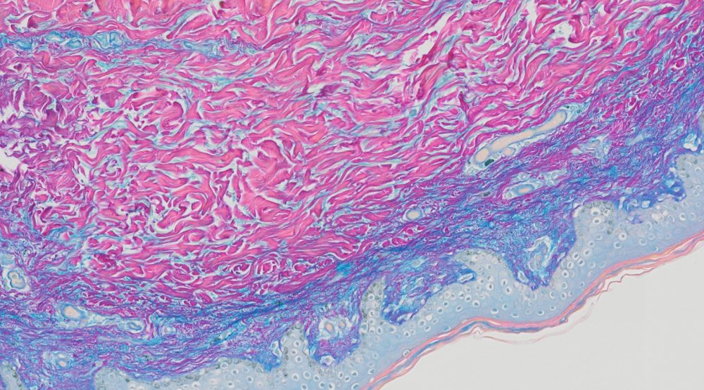 VitroView™ Colloidal Iron Stain Kit