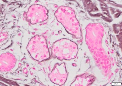 VitroView™ Jones Stain Kit (Basement Membrane)