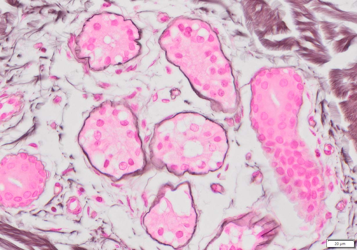VitroView™ Jones Stain Kit (Basement Membrane)
