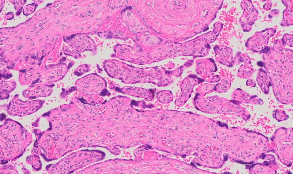 Human Placenta Tissue (Normal) FFPE Sections