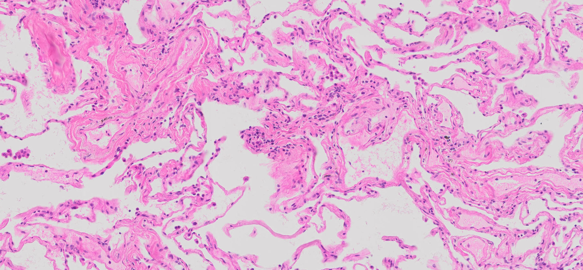 Human Lung Tissue (Normal) FFPE Sections