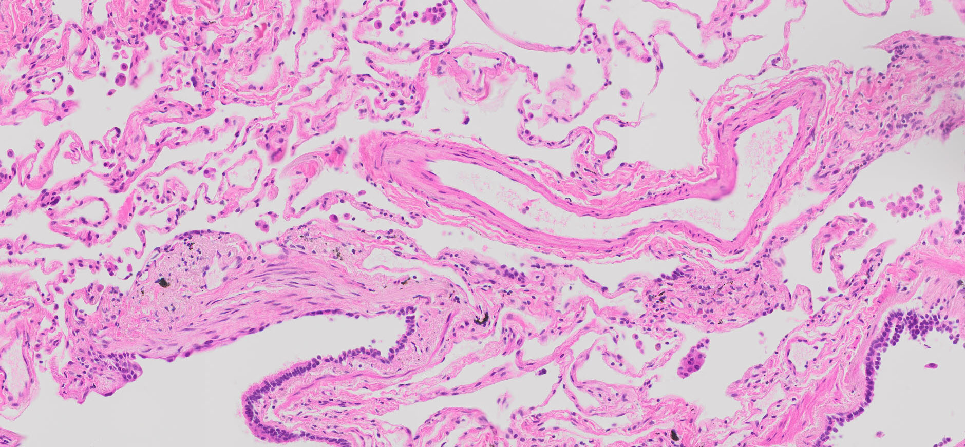 Human Lung Tissue (Normal) FFPE Sections