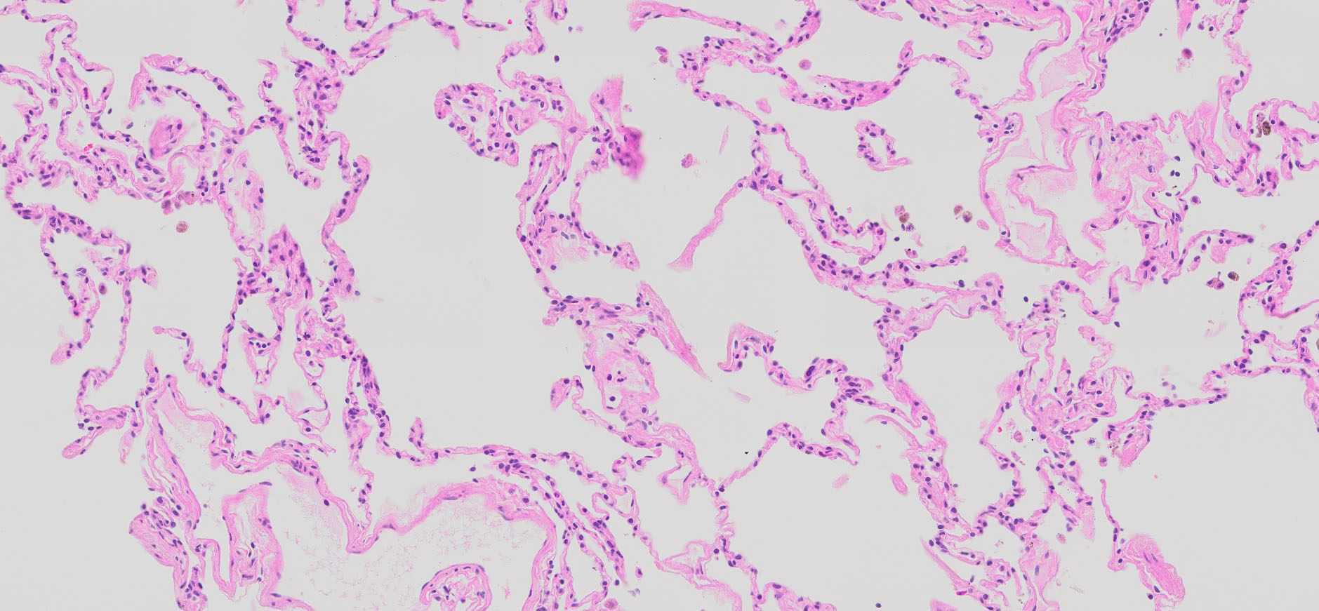 Human Lung Tissue (Normal) FFPE Sections