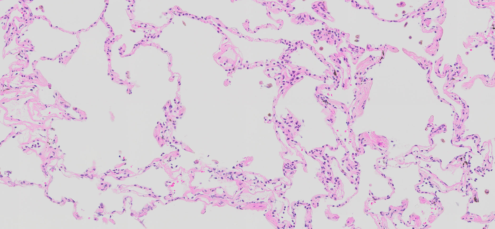 Human Lung Tissue (Normal) FFPE Sections