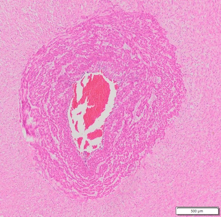 Human Umbilical Cord (Normal) FFPE Sections