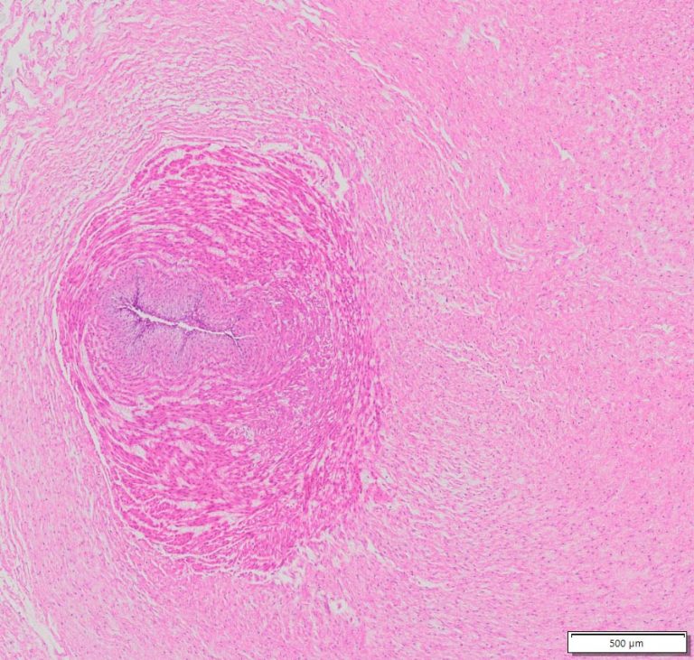 Human Umbilical Cord (Normal) FFPE Sections
