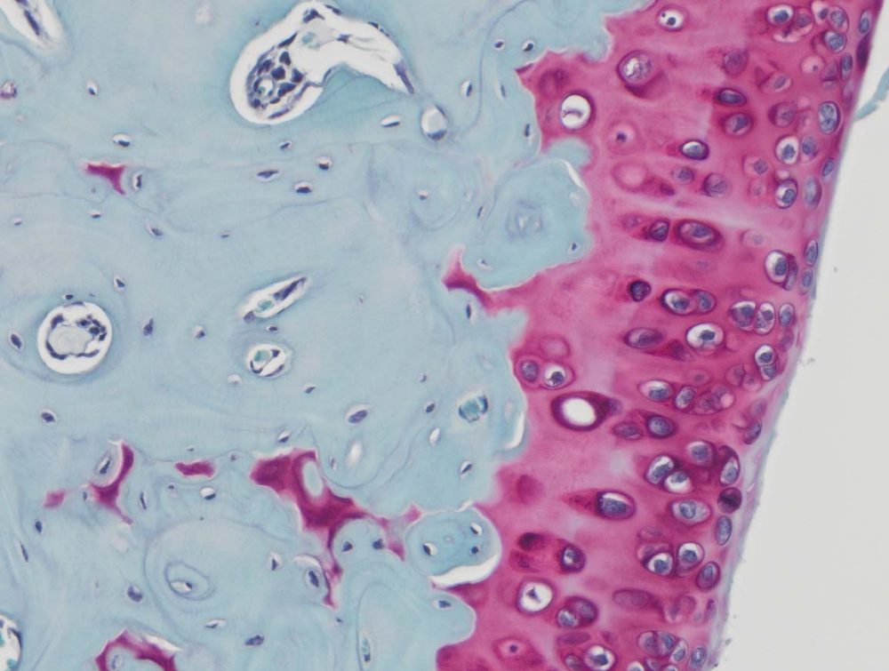 VitroView™ Safranin O Stain Kit for Cartilage