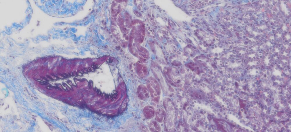 VitroView™ Verhoeff Elastic Masson Trichrome Stain Kit