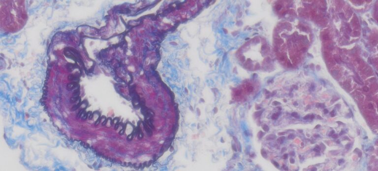 VitroView™ Verhoeff Elastic Masson Trichrome Stain Kit