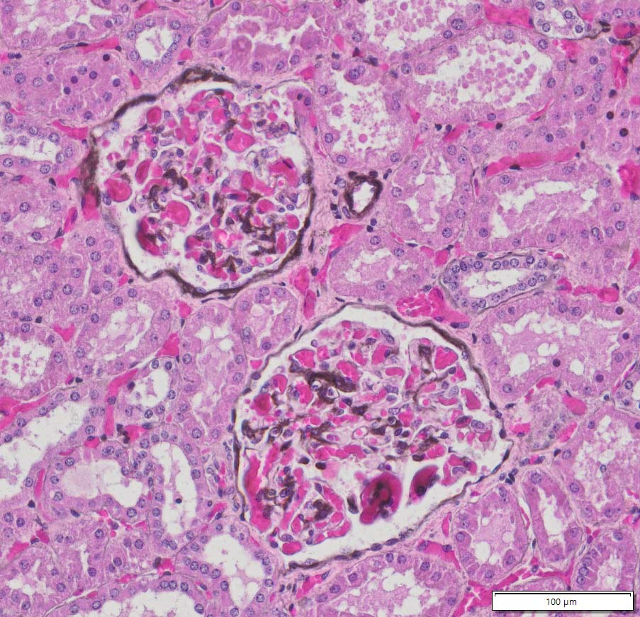 VitroView™ Periodic Acid Silver Methenamin Stain Kit