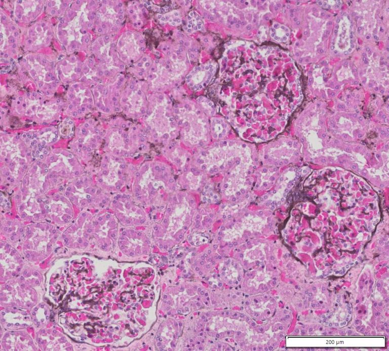 VitroView™ Periodic Acid Silver Methenamin Stain Kit