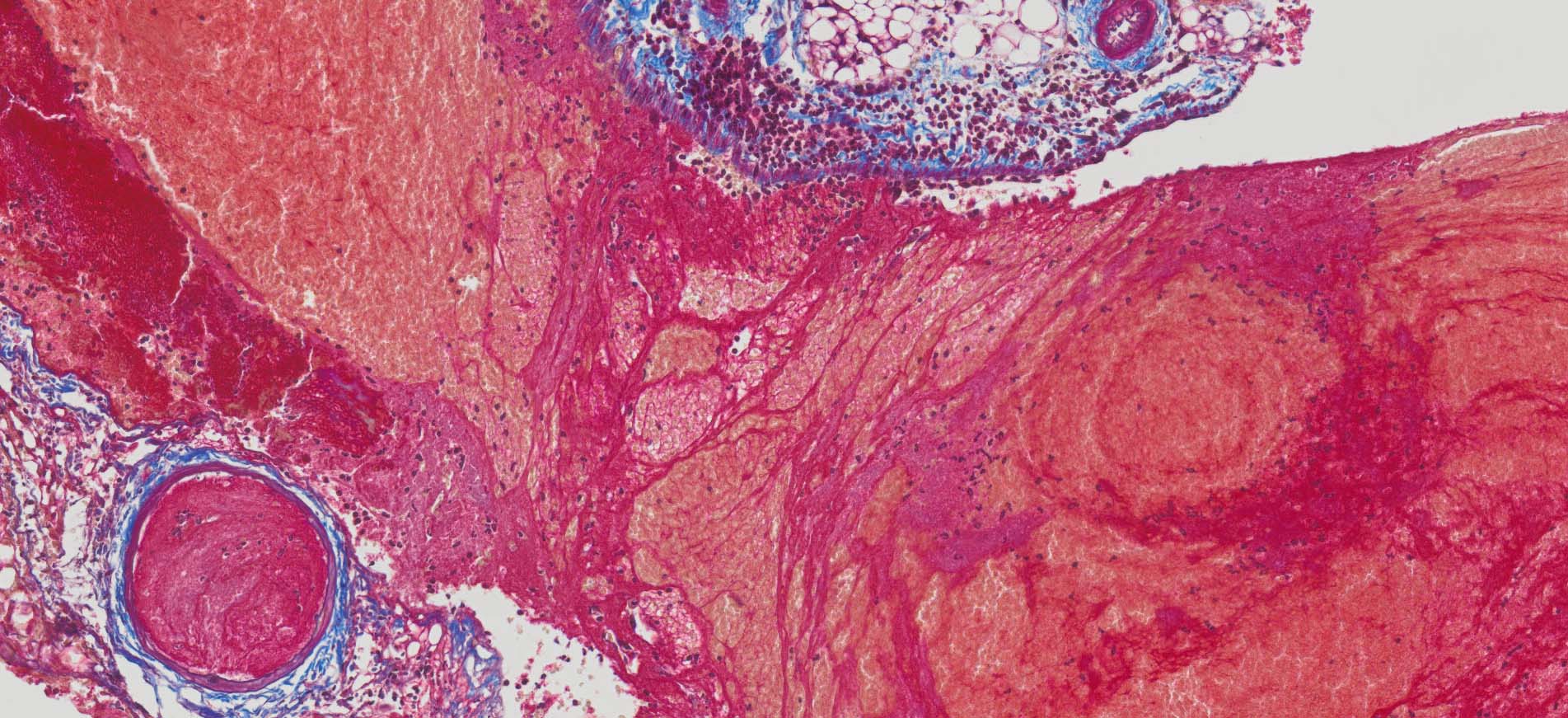 VitroView™ Martius Scarlet Blue (MSB) Stain Kit