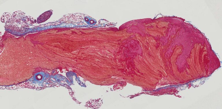 VitroView™ Martius Scarlet Blue (MSB) Stain Kit