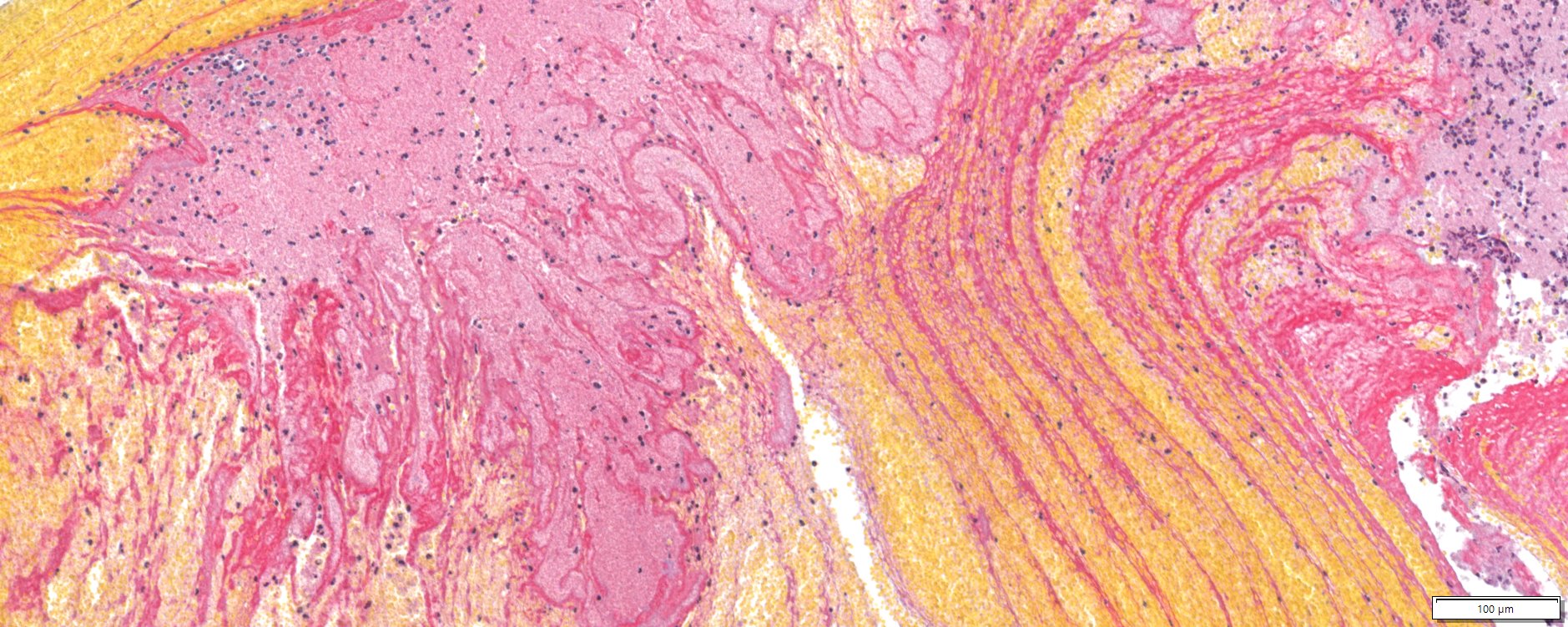 VitroView™ Martius Scarlet Blue (MSB) Stain Kit