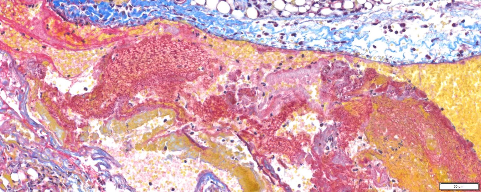 VitroView™ Martius Scarlet Blue (MSB) Stain Kit