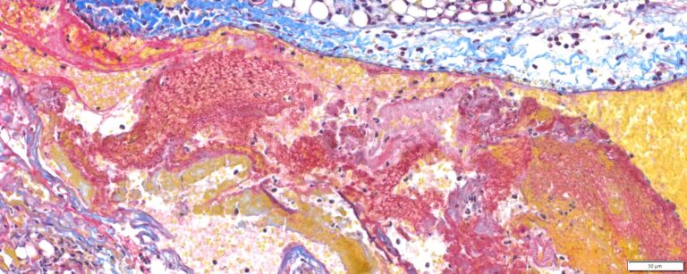 VitroView™ Martius Scarlet Blue (MSB) Stain Kit