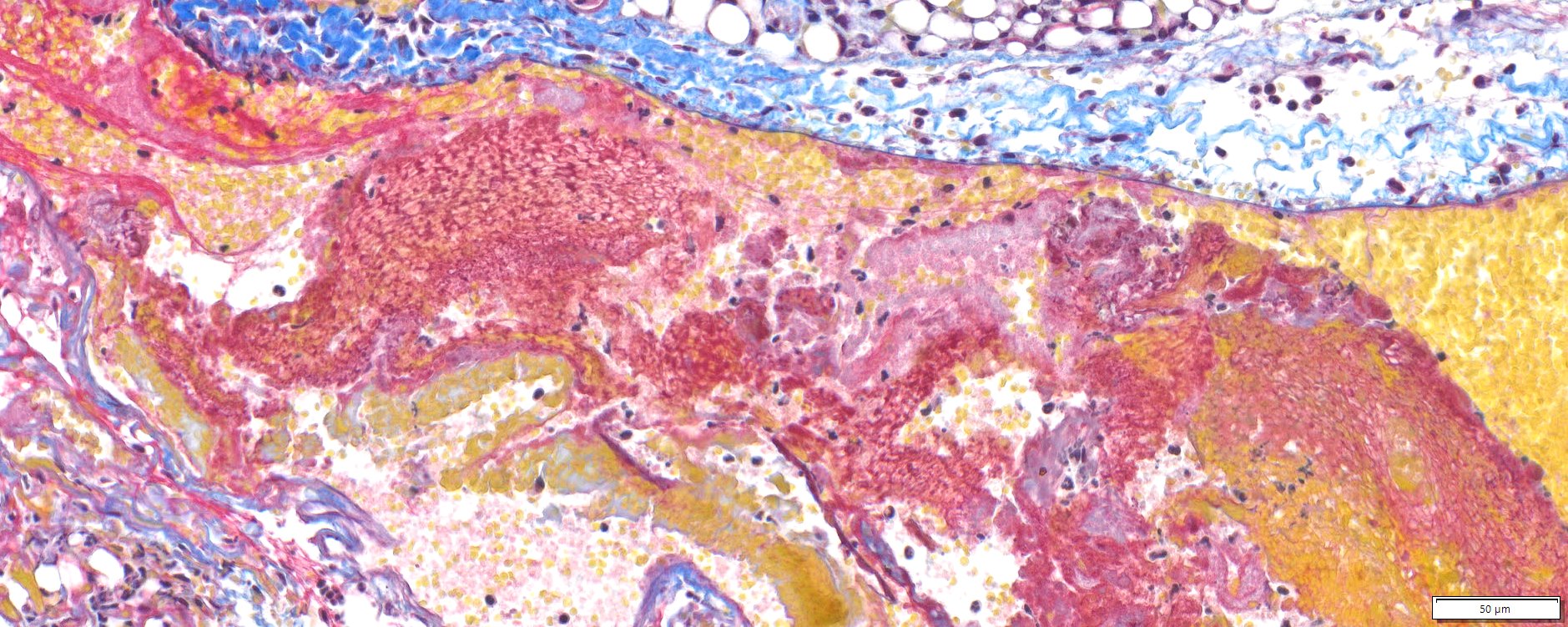 VitroView™ Martius Scarlet Blue (MSB) Stain Kit