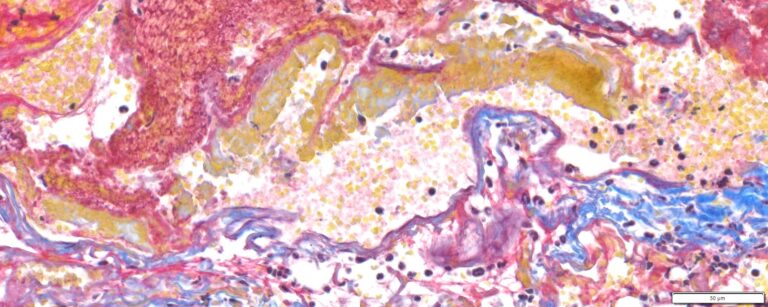 VitroView™ Martius Scarlet Blue (MSB) Stain Kit