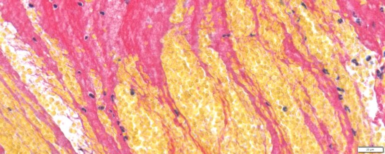 VitroView™ Martius Scarlet Blue (MSB) Stain Kit