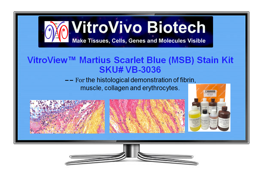 VitroView™ Martius Scarlet Blue (MSB) Stain Kit