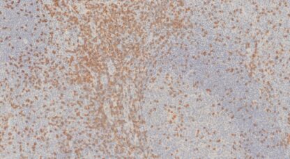 Human Tonsil Tissue (Normal) FFPE Sections