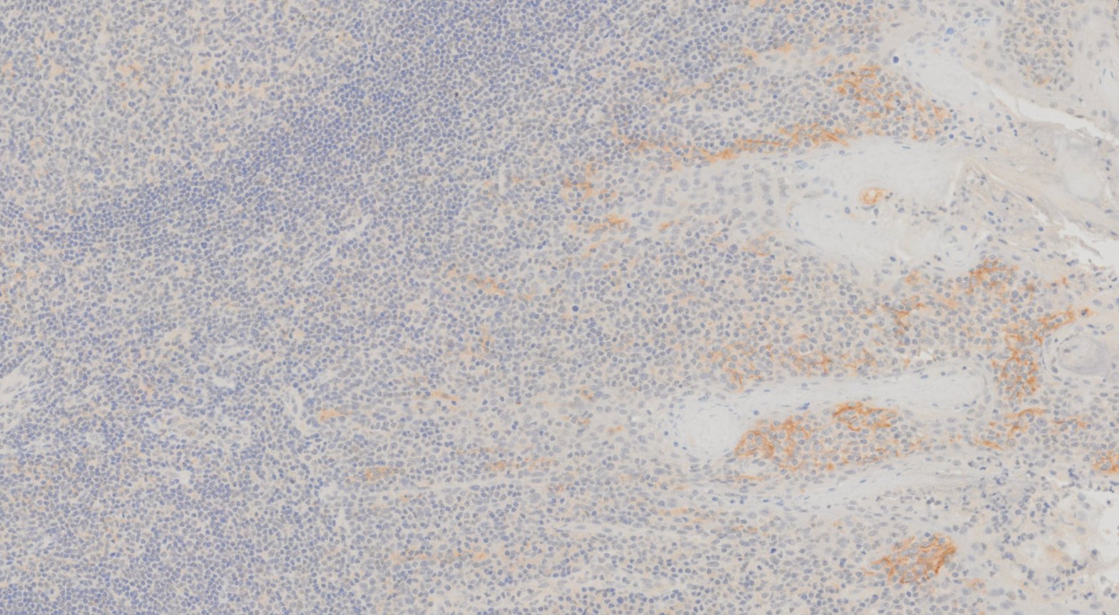 Human Tonsil Tissue (Normal) FFPE Sections