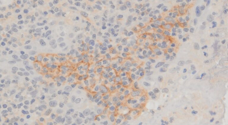 Human Tonsil Tissue (Normal) FFPE Sections