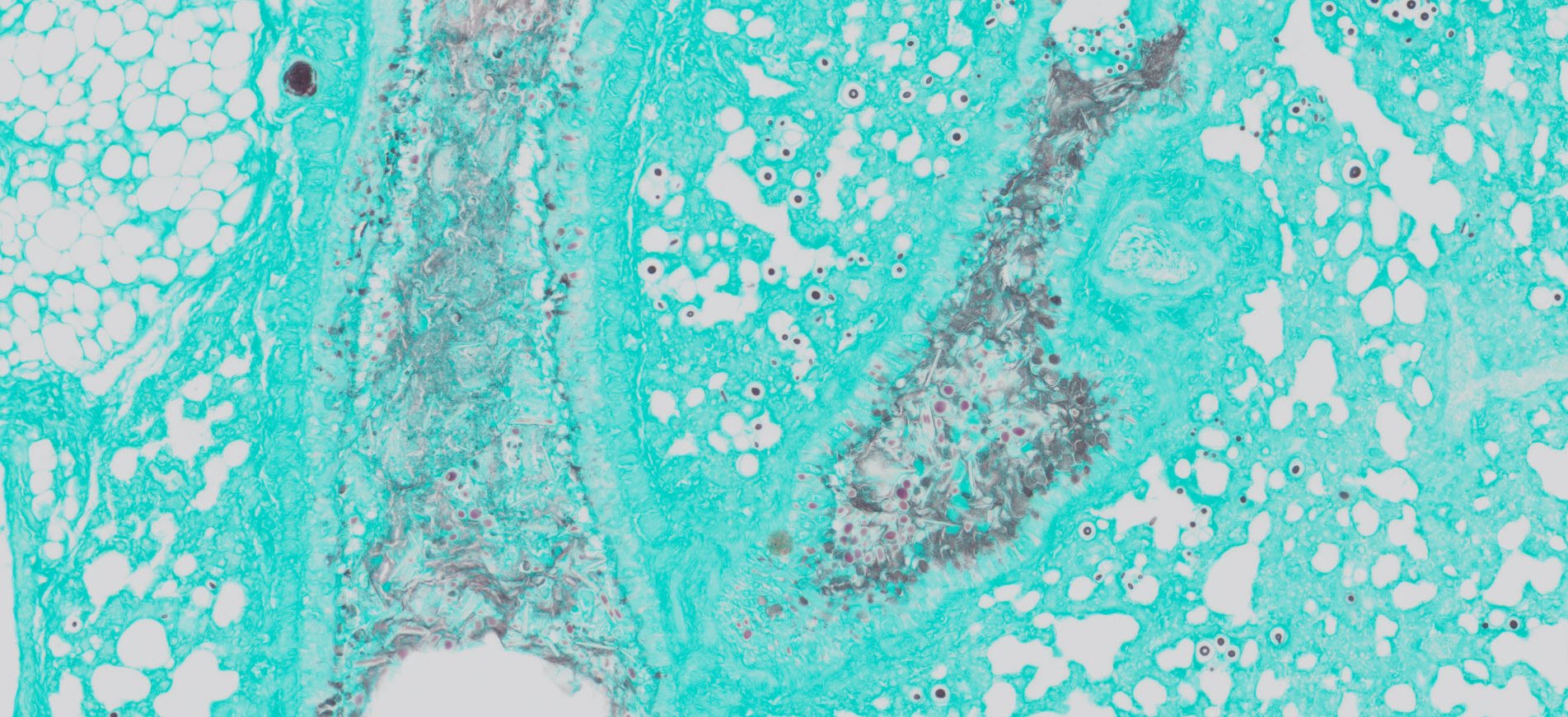 VitroView™ Grocott-Gomori’s Methenamine Silver (GMS) Stain Kit