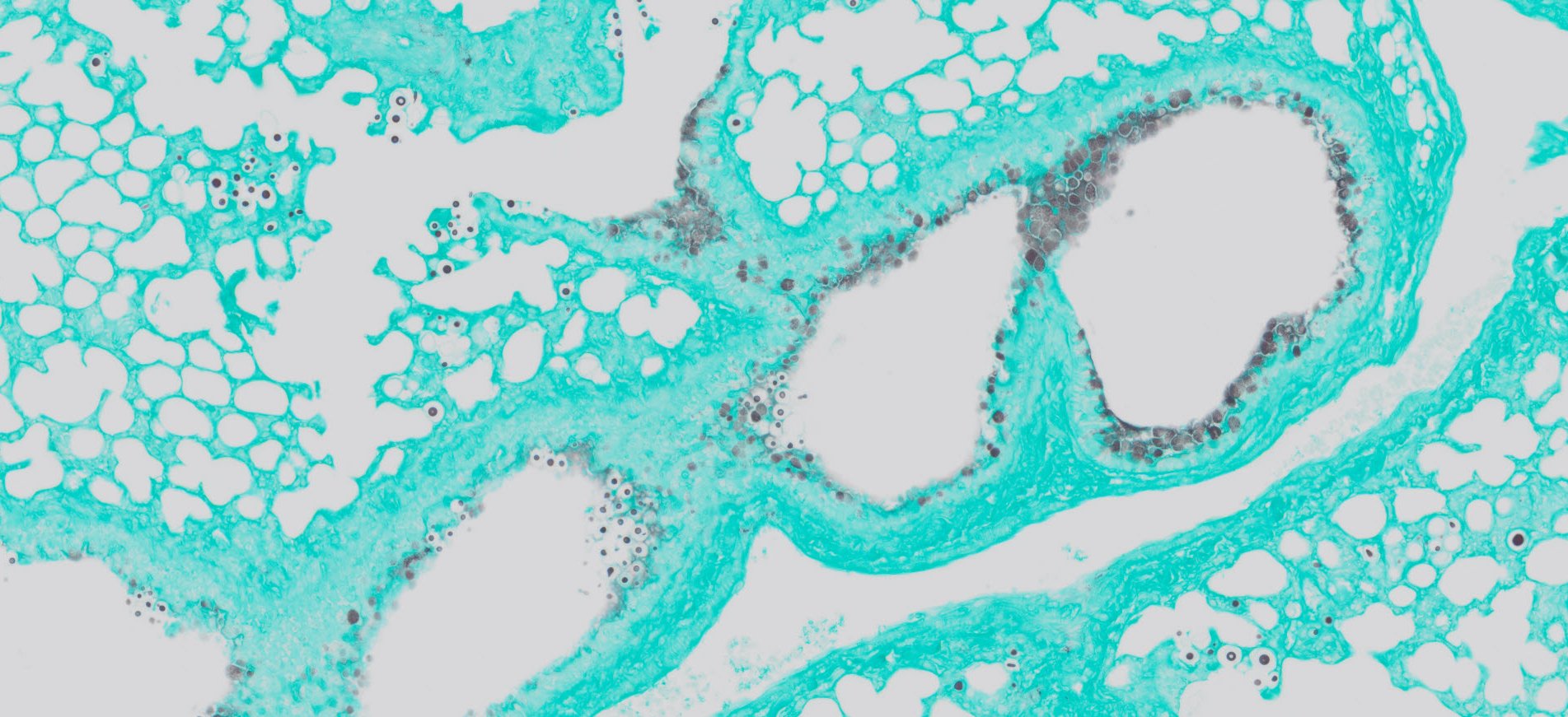 VitroView™ Grocott-Gomori’s Methenamine Silver (GMS) Stain Kit