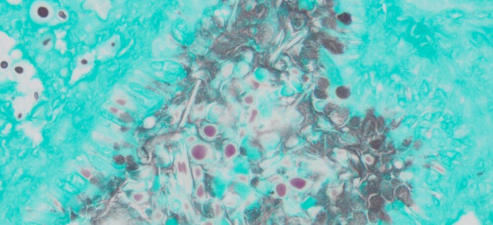 VitroView™ Grocott-Gomori’s Methenamine Silver (GMS) Stain Kit