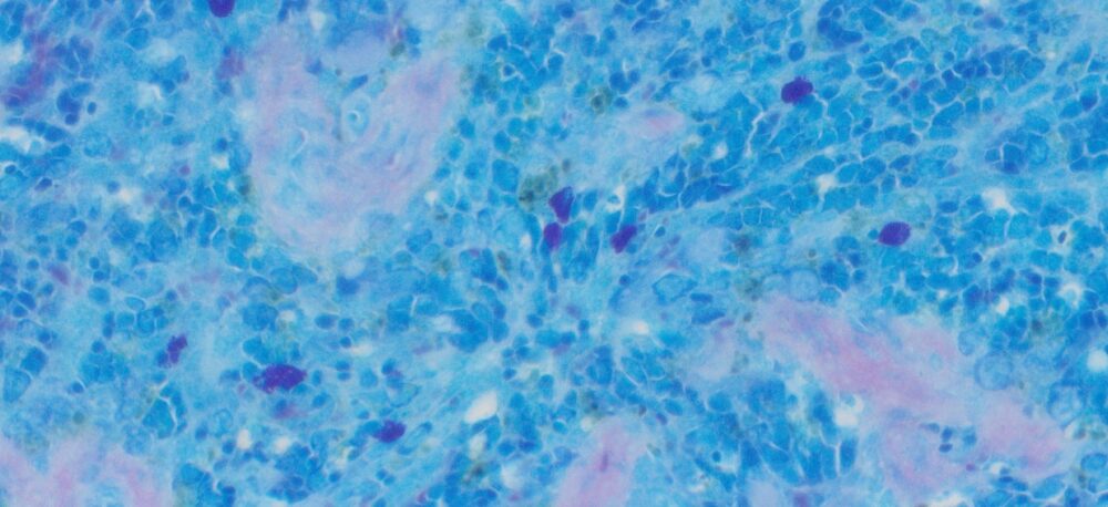 VitroView™ Giemsa Stain Kit