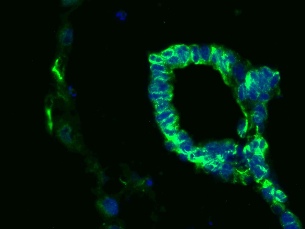 VitroView™ Anti-Rabbit Immunofluorescenc Staining Kit (Green, 50-100 ...