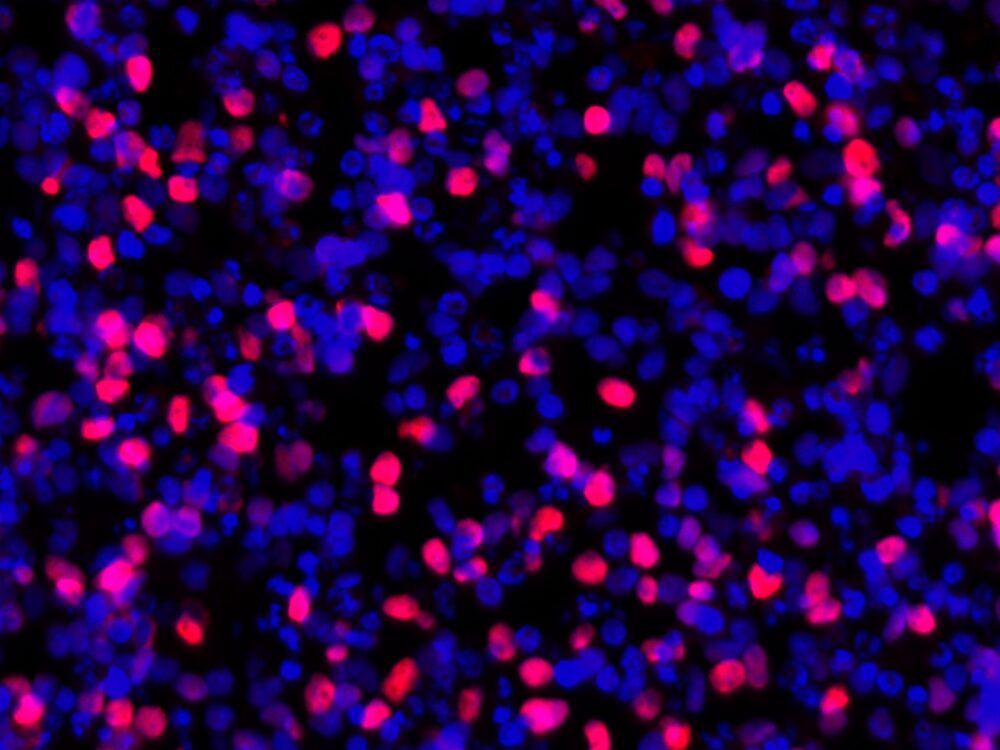 VitroView™ Anti-Goat Immunofluorescenc Staining Kit (Red, 50-100 slides) VitroView™ Anti-Goat Immunofluorescenc Staining Kit (Red, 50-100 slides)