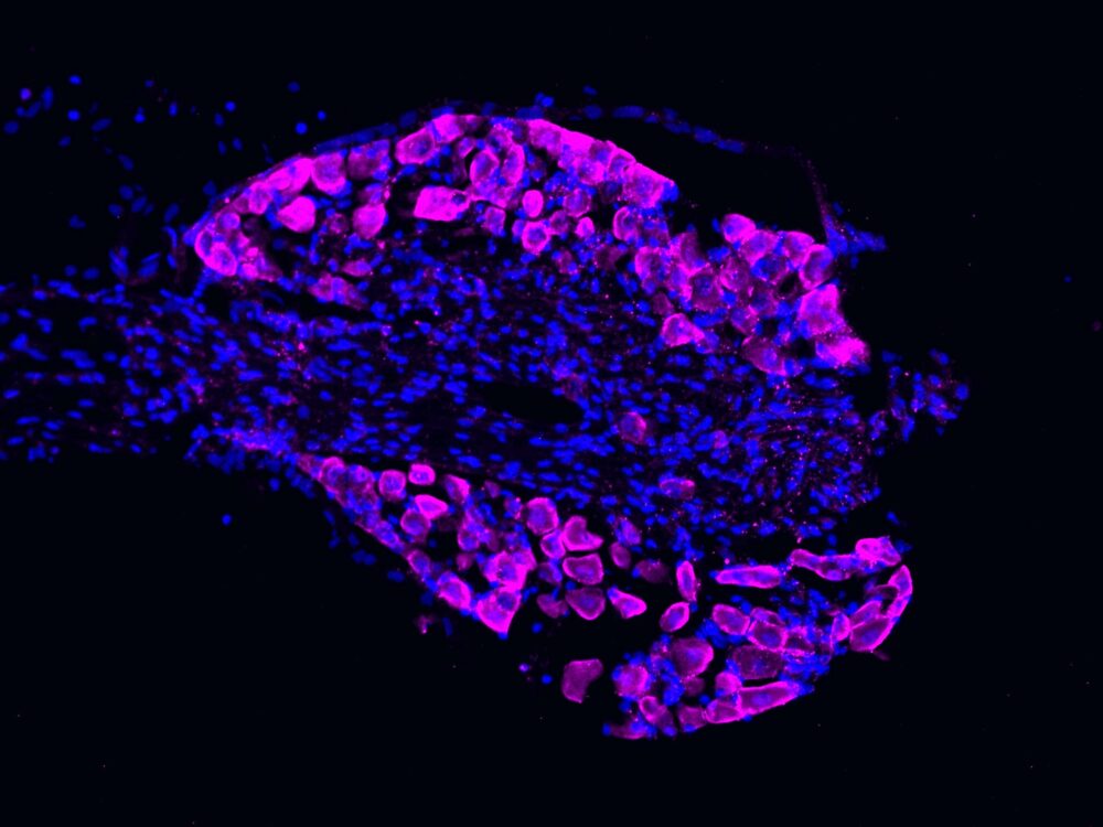 VitroView™ Anti-Goat Immunofluorescenc Staining Kit (Far Red, 50-100 ...