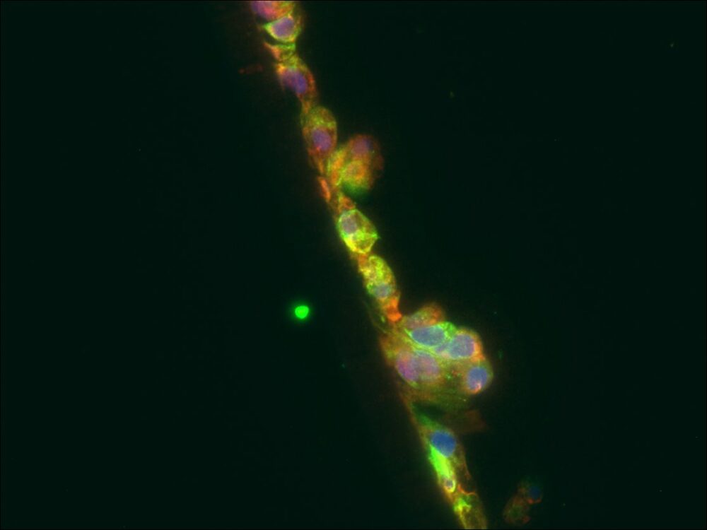 VitroView™ Immunofluorescence Double Staining Kit, FL488 Anti-Mouse ...
