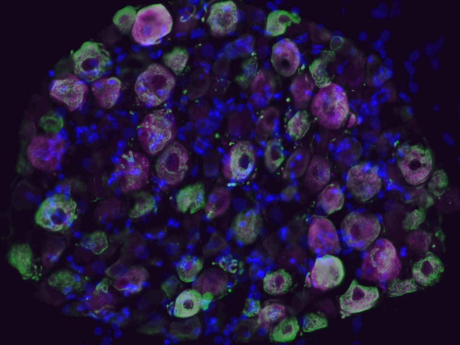 VitroView™ Immunofluorescence Double Staining Kit, FL488 Anti-Mouse ...