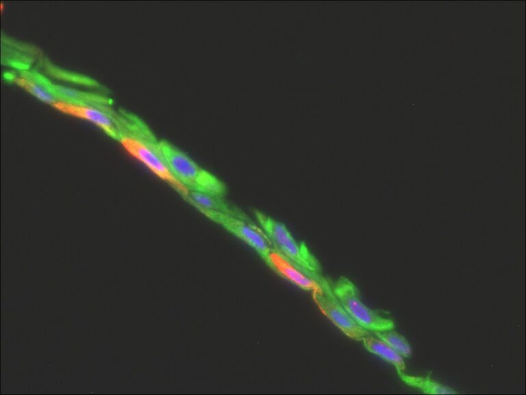 VitroView™ Immunofluorescence Double Staining Kit, FL594 Anti-Mouse ...