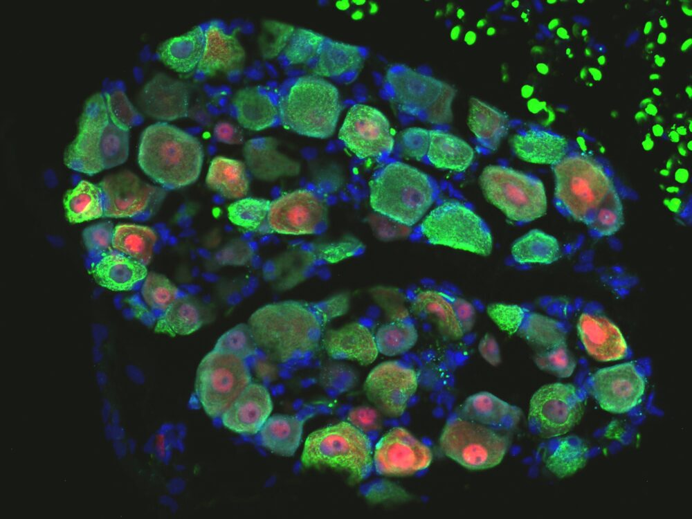VitroView™ Immunofluorescence Triple Staining Kit, FL488 Anti-Mouse ... VitroView™ Immunofluorescence Triple Staining Kit, FL488 Anti-Mouse ...