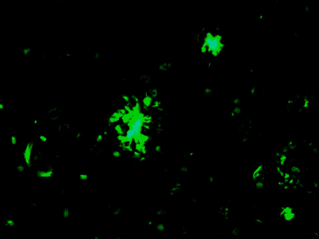 VitroView™ Thioflavin S Stain Kit