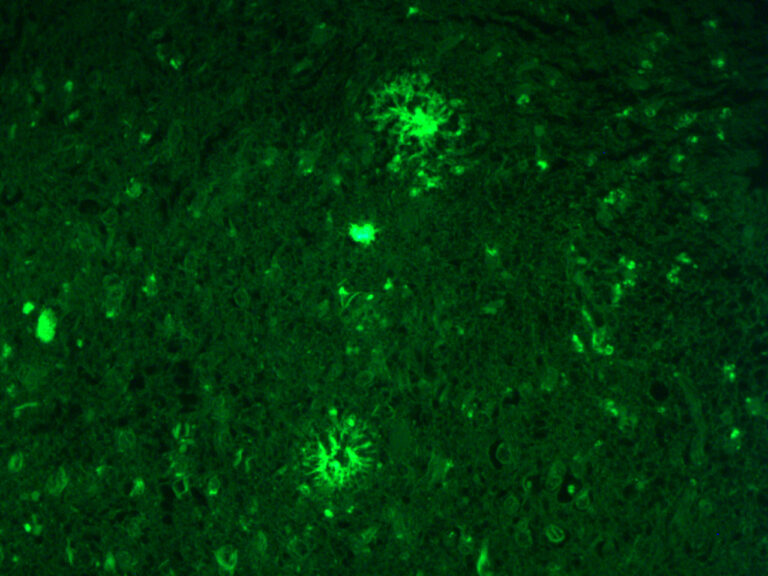 VitroView™ Thioflavin S Stain Kit