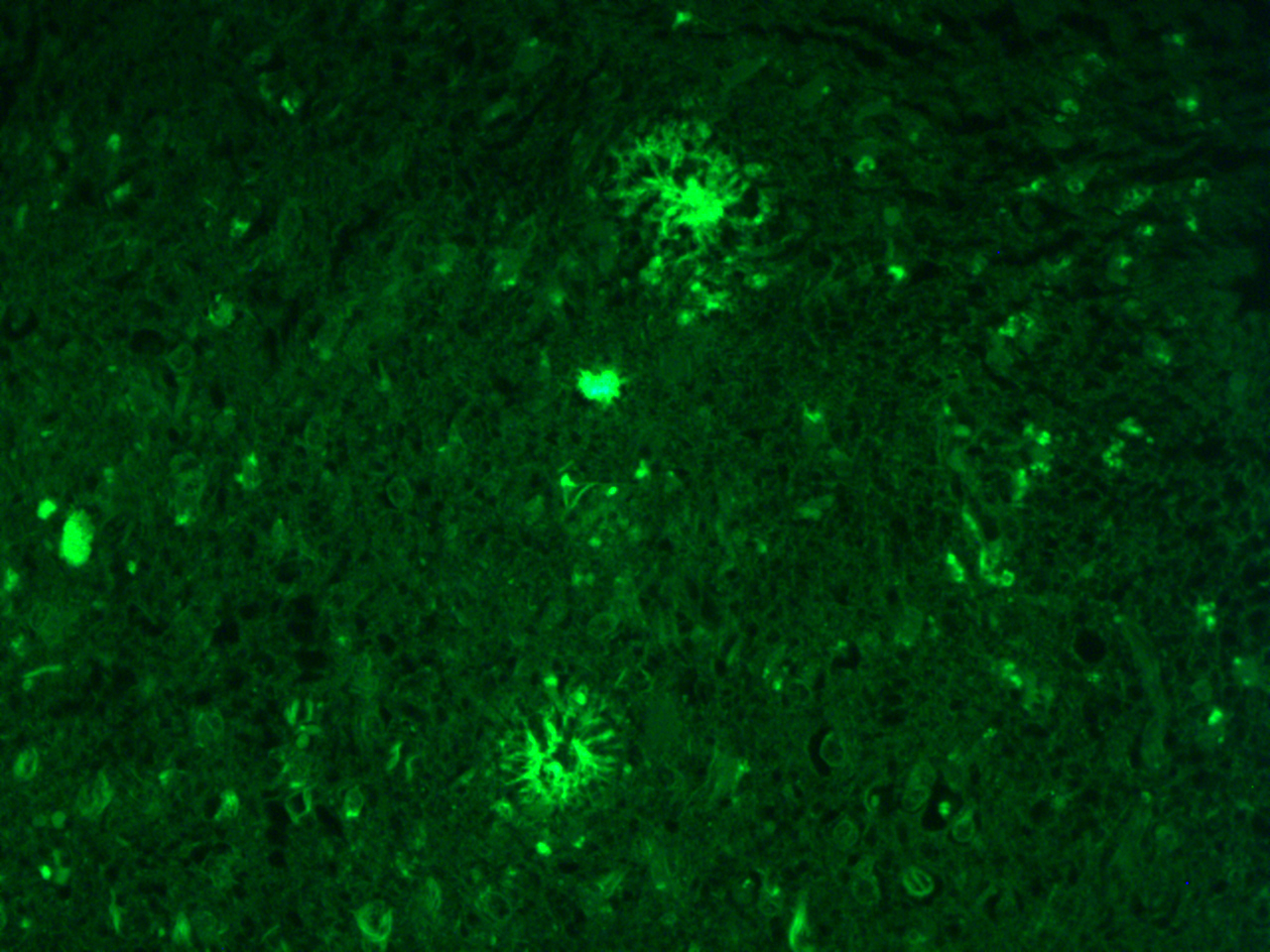 VitroView™ Thioflavin S Stain Kit