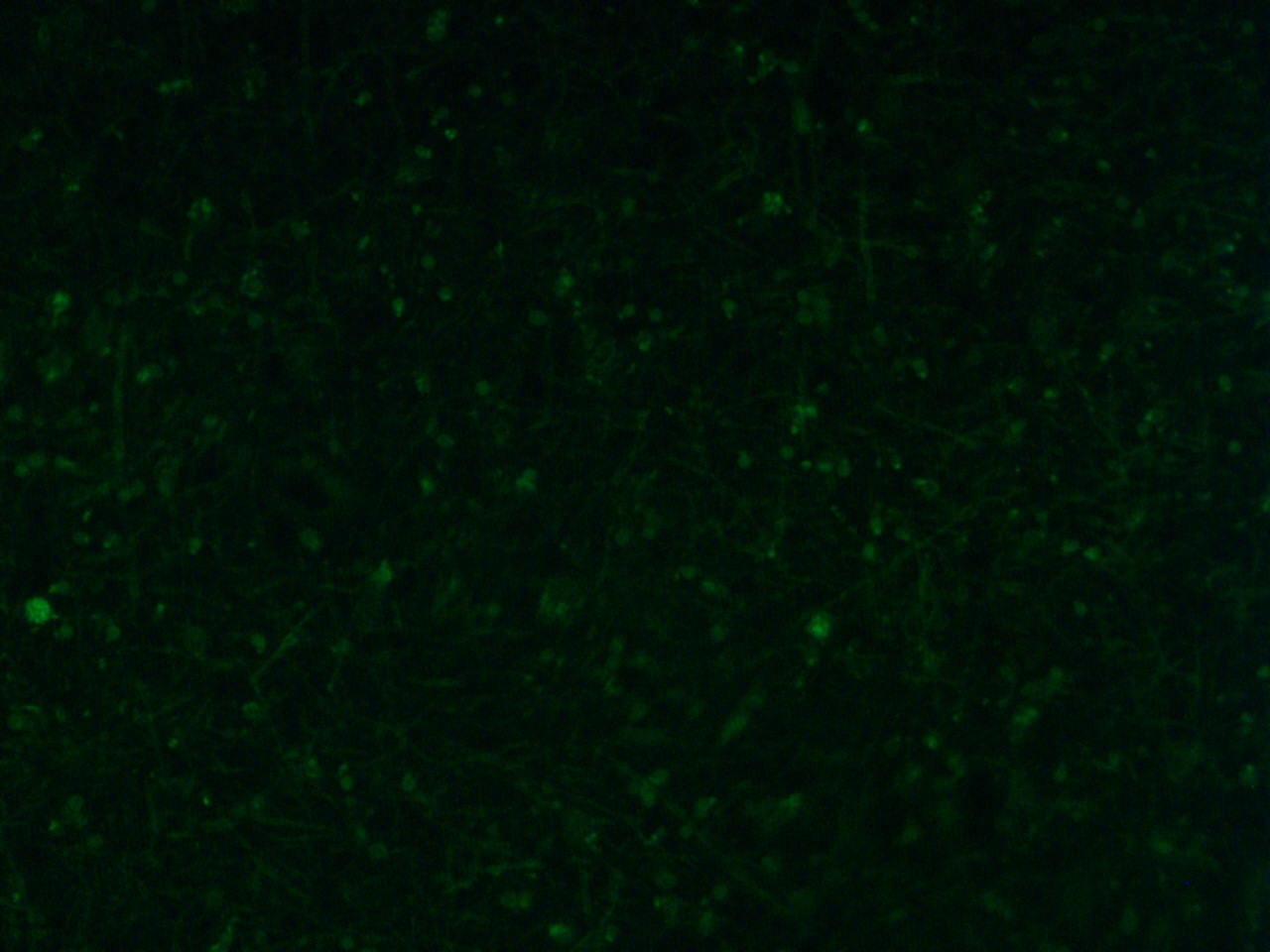 VitroView™ Thioflavin S Stain Kit