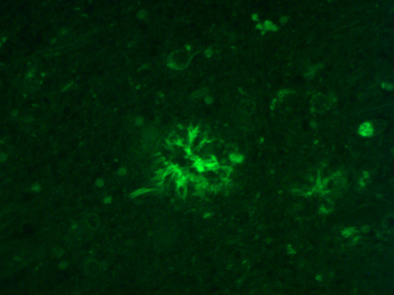 VitroView™ Thioflavin S Stain Kit