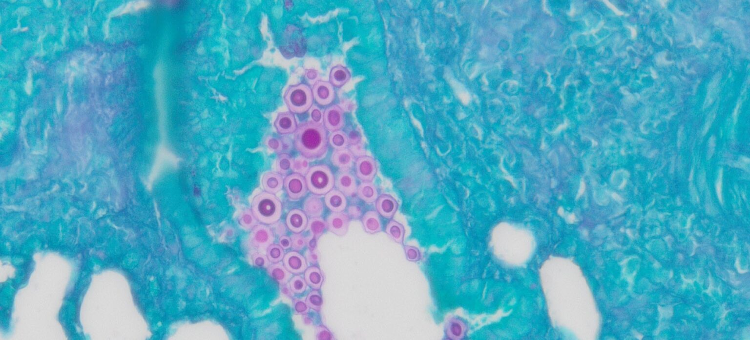 VitroView™ Periodic Acid Schiff (PAS) for Fungus Stain Kit