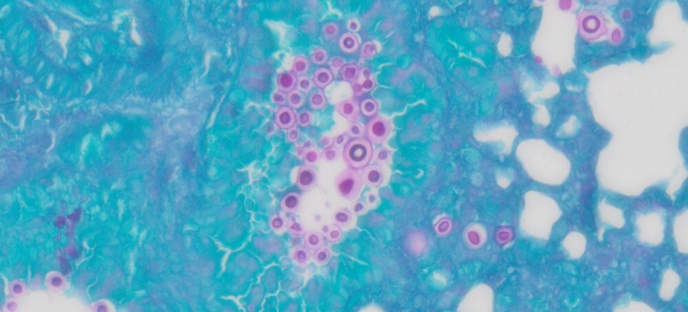 VitroView™ Periodic Acid Schiff (PAS) for Fungus Stain Kit