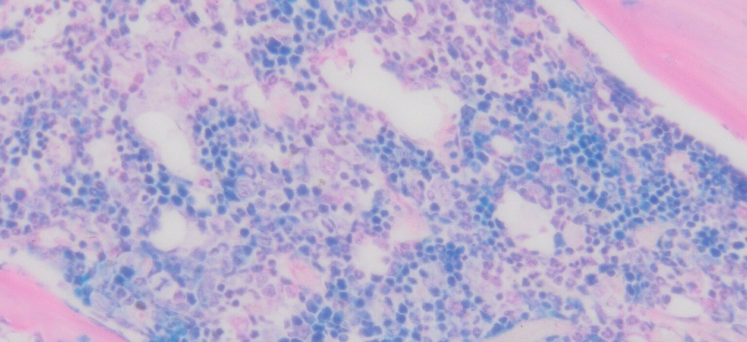 VitroView™ Differential Quik Stain Kit