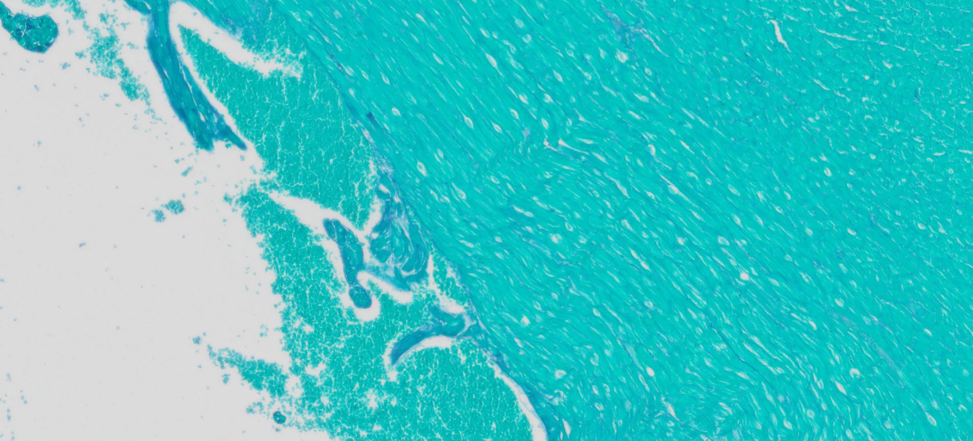 VitroView™ Periodic Acid Schiff (PAS) for Fungus Stain Kit