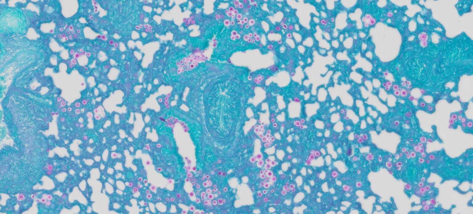 VitroView™ Periodic Acid Schiff (PAS) for Fungus Stain Kit