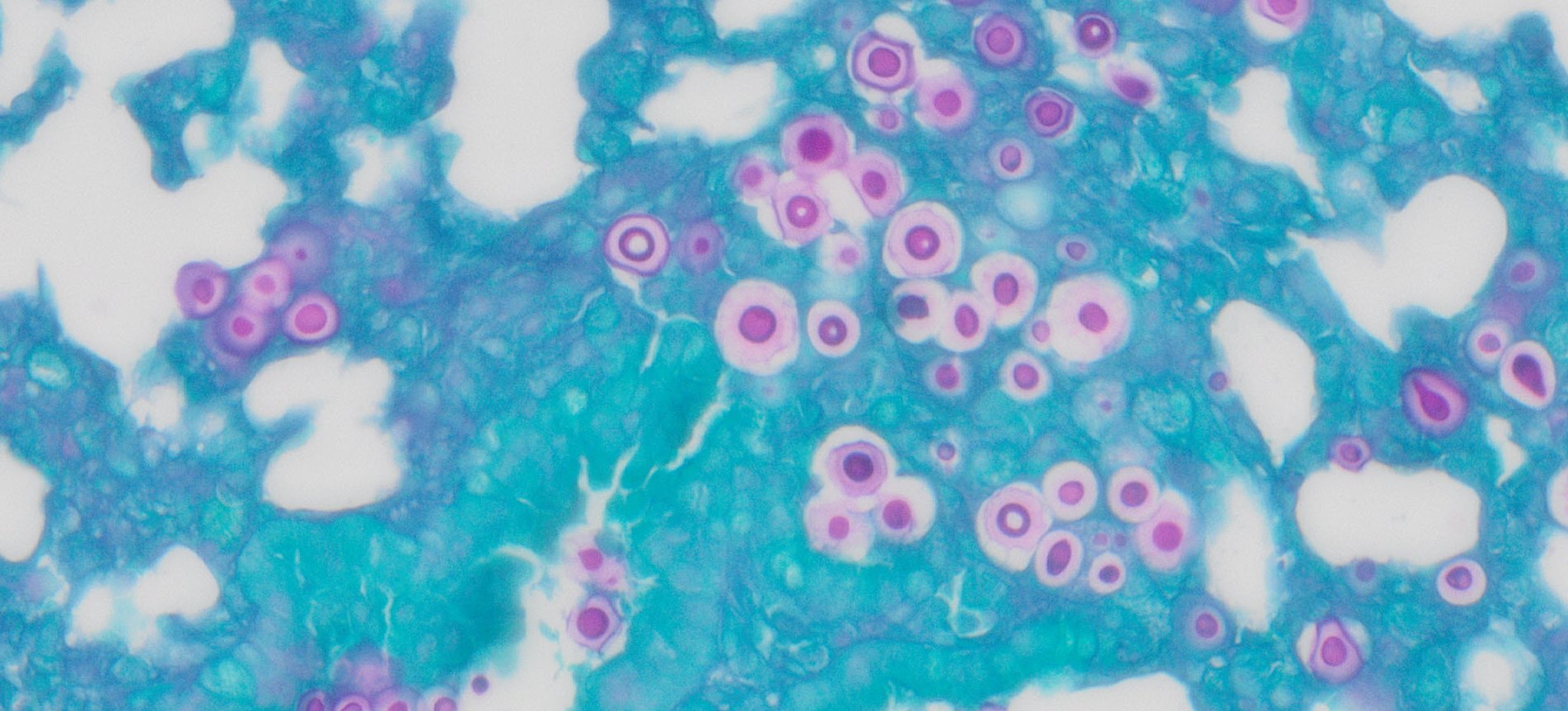 VitroView™ Periodic Acid Schiff (PAS) for Fungus Stain Kit