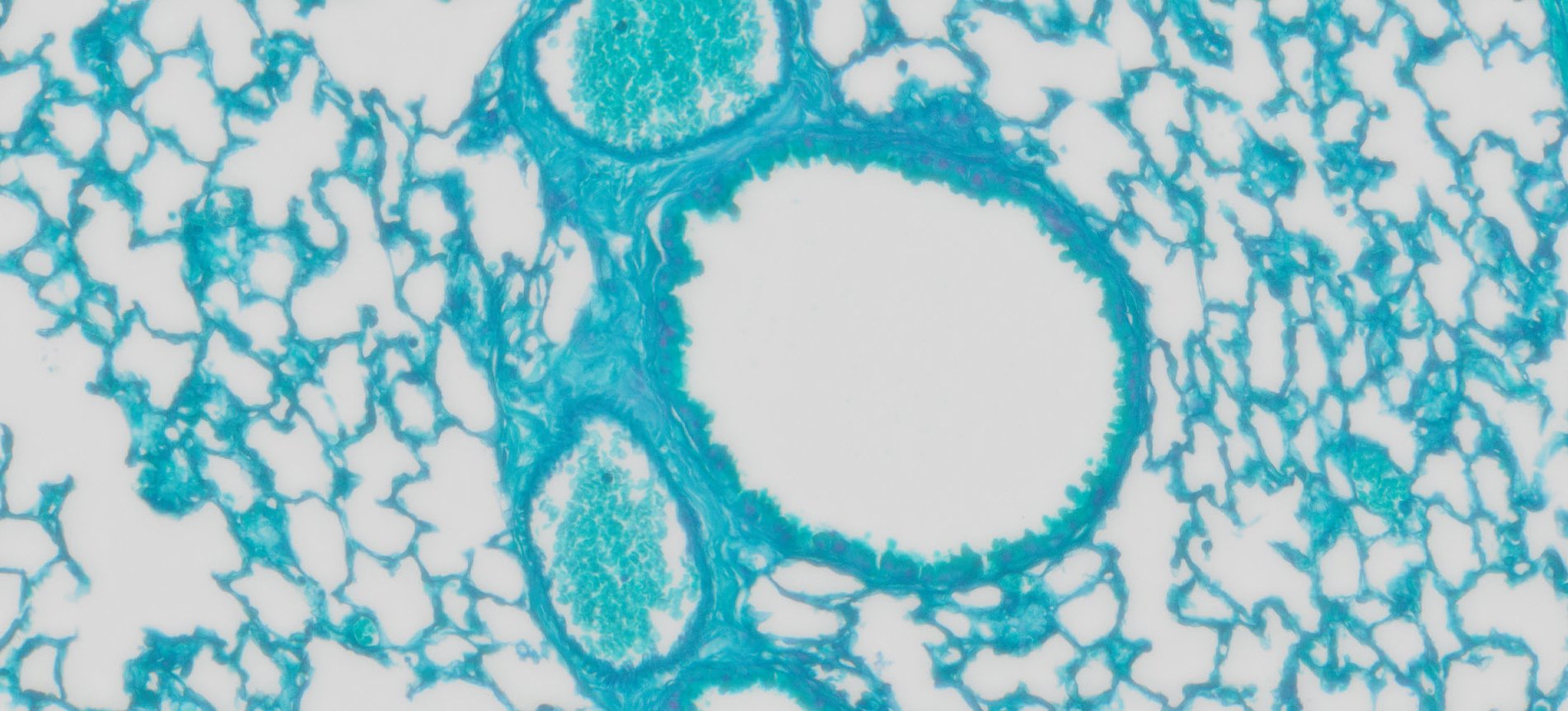 VitroView™ Periodic Acid Schiff (PAS) for Fungus Stain Kit